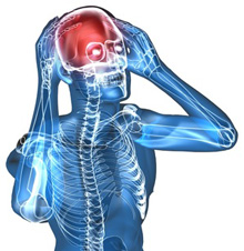 sixsexysirens: How Your healer mitigated cephalalgia Pain